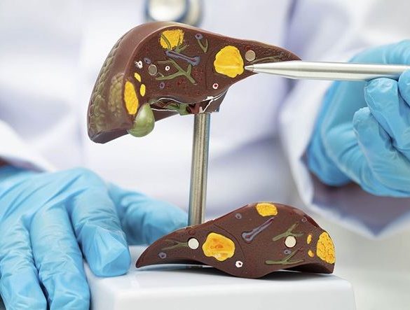 Rising Cases of High Blood Pressure in Children Highlight Growing ...