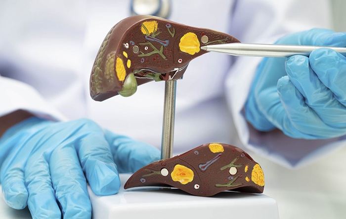 Breakthrough Strategy Offers Hope for Liver Disease Treatment by ...